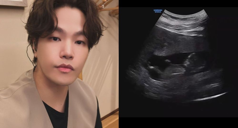 Na Yoon Kwon, Becomes a Father! Heartwarming News with Ultrasound Photo ...